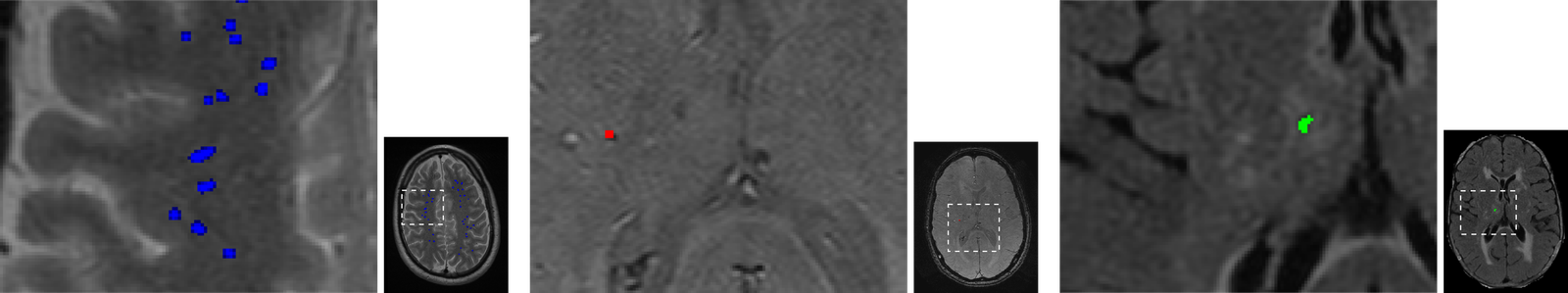 Where is VALDO? – Medical Imaging