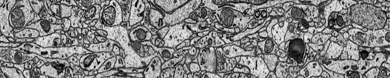 MitoEM – Medical Imaging